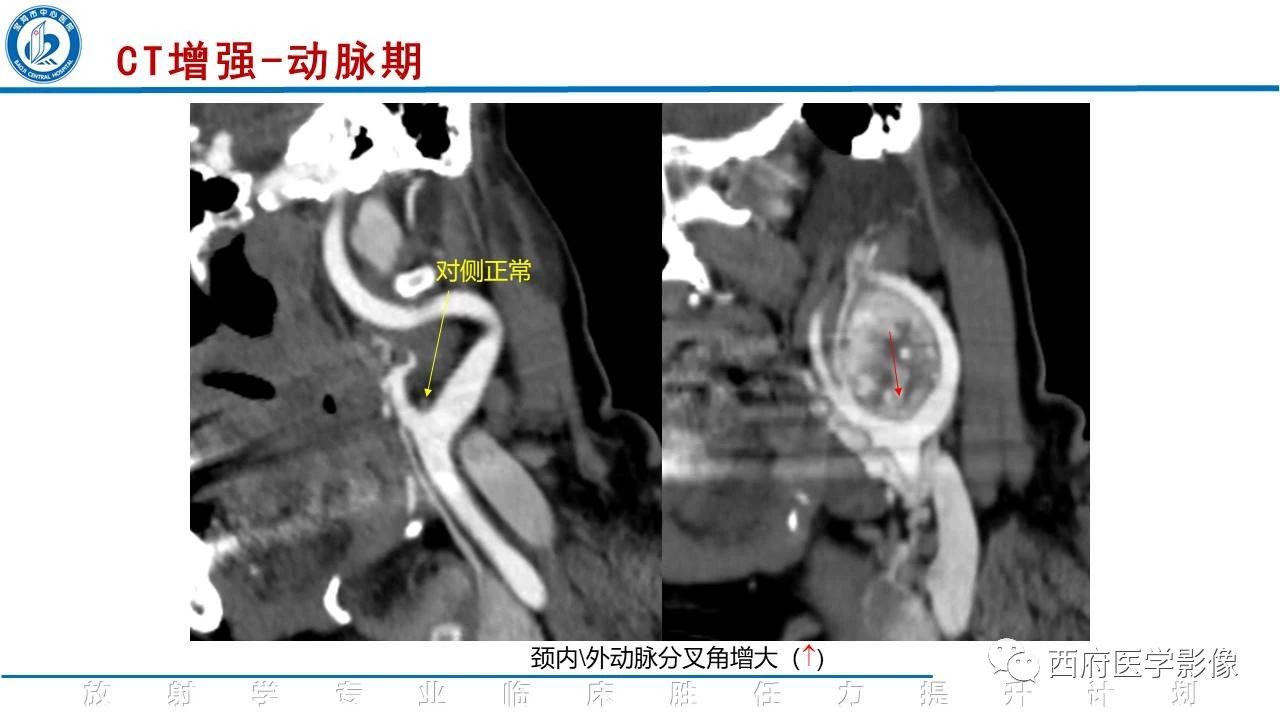 好文分享—— - 資訊咖