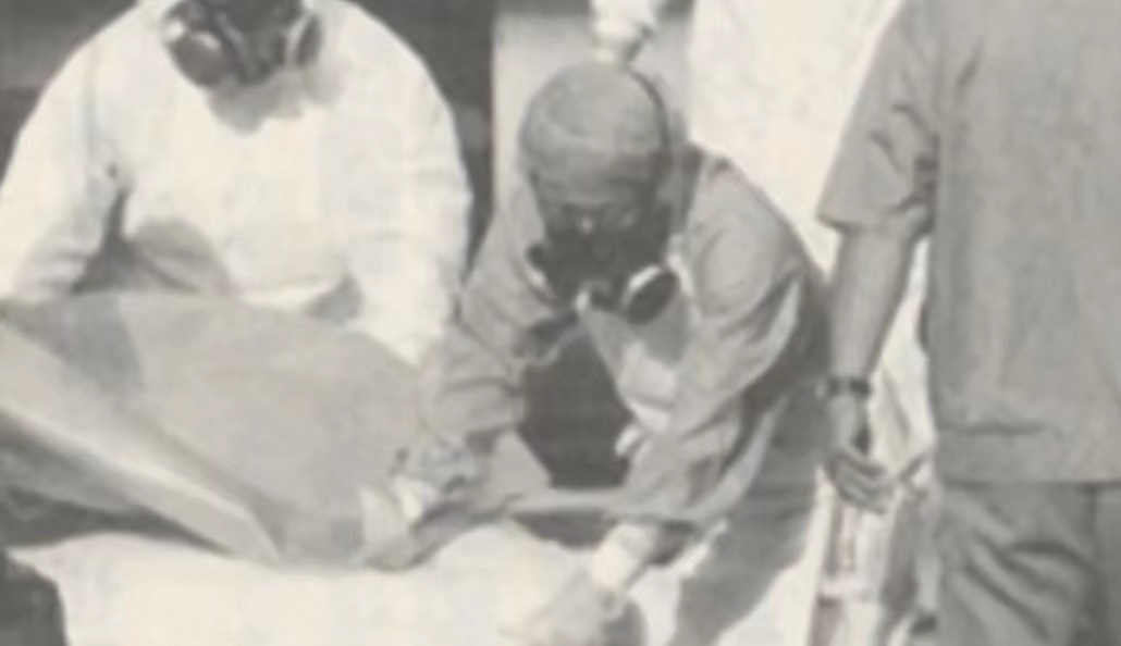 Japanese was forced to live for 83 days after being exposed to nuclear ...