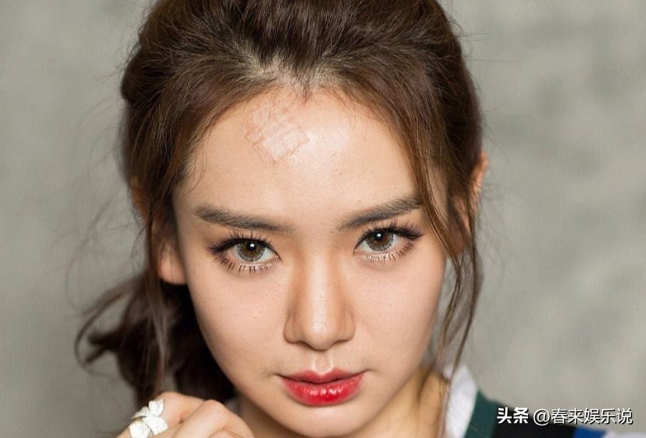 Whether the brain gate is high hairline or overfilled, look at the 10 ...