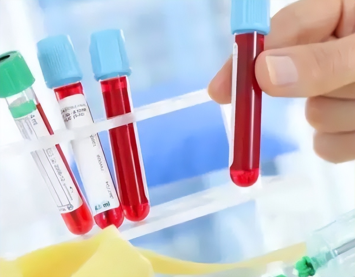 In the blood routine examination, if these three indicators are ...