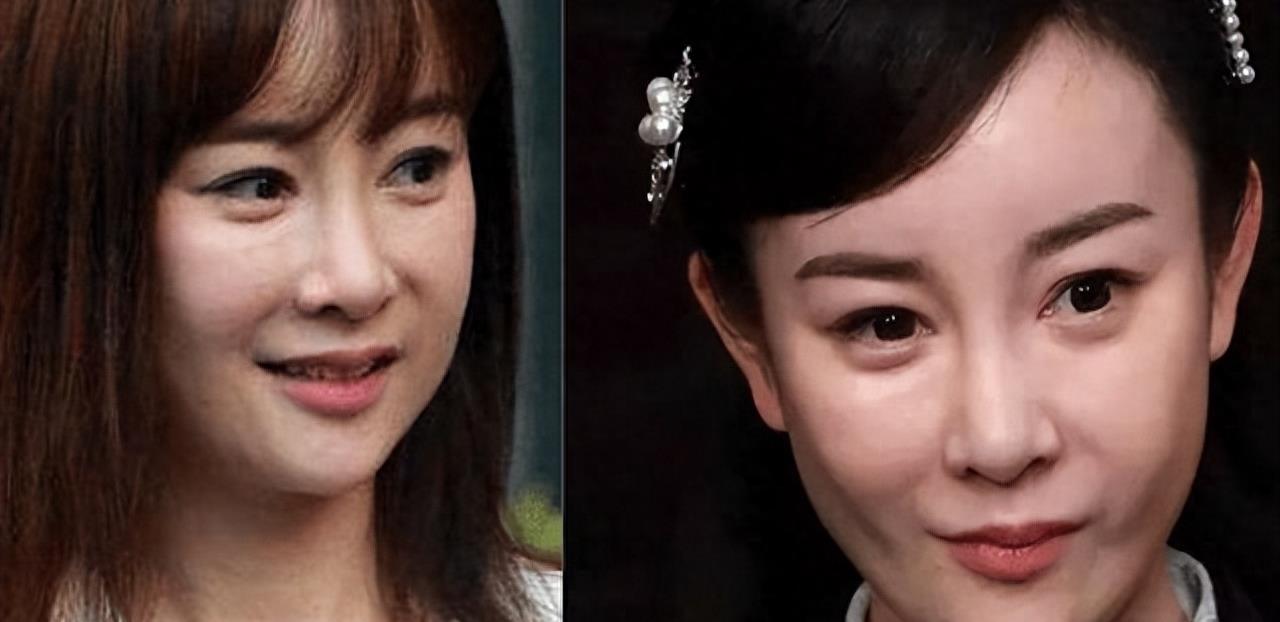 The actress who is addicted to plastic surgery has transformed herself ...