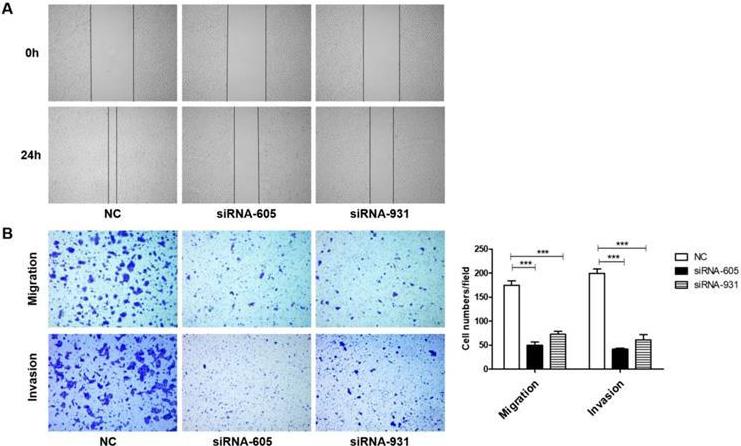 Fusion of Bacteroides fragilis reveals the role of FeoA in stabilizing ...