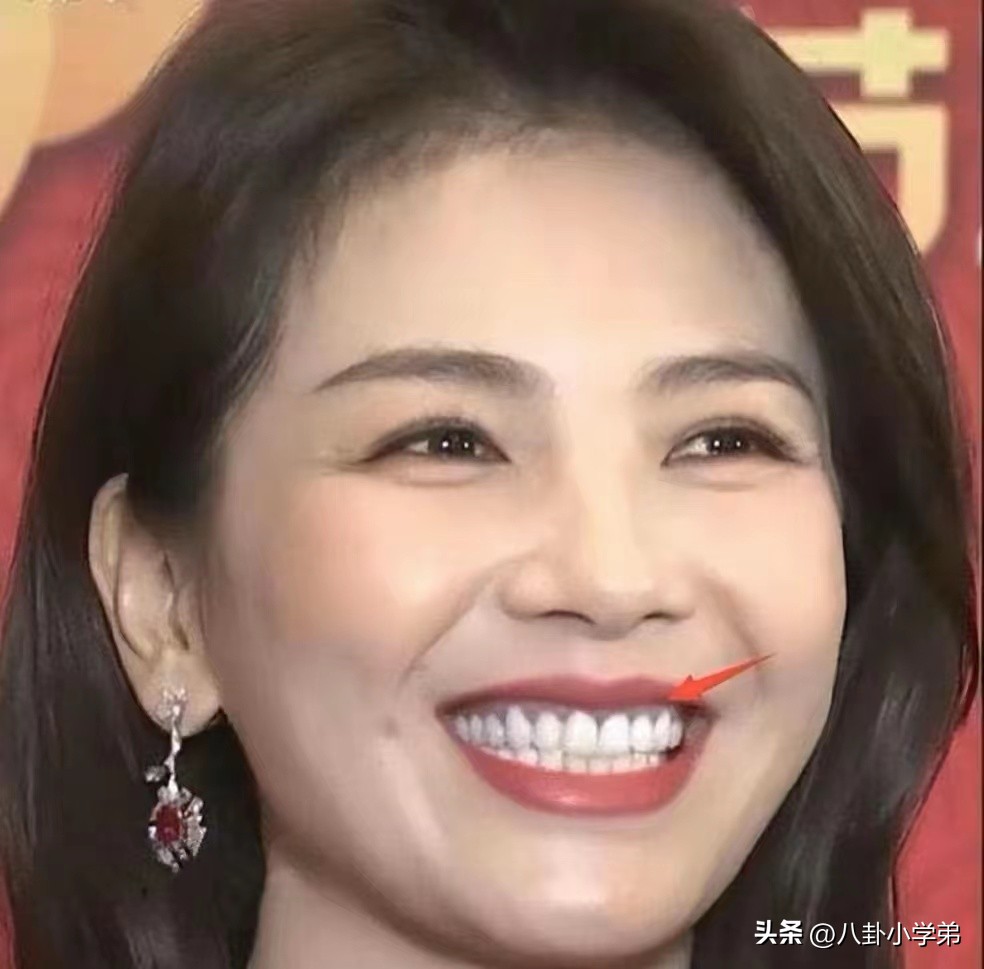 In the entertainment industry, each person has a pair of porcelain ...