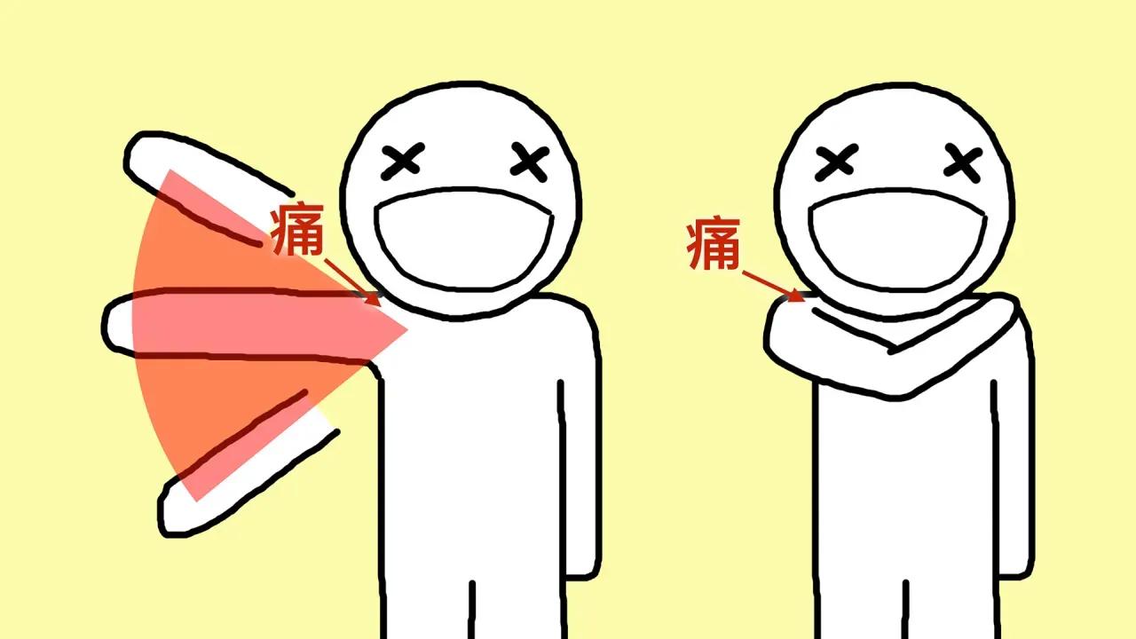 The most common shoulder pain: shoulder pinching syndrome - iMedia