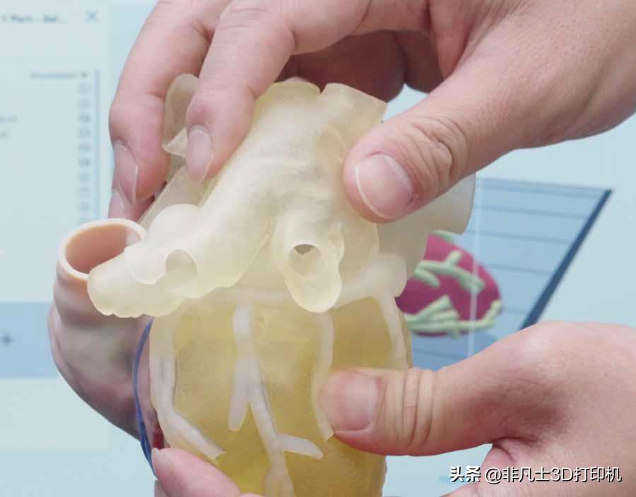 Xijing Hospital uses J850 to reduce the risk of heart surgery - iNEWS