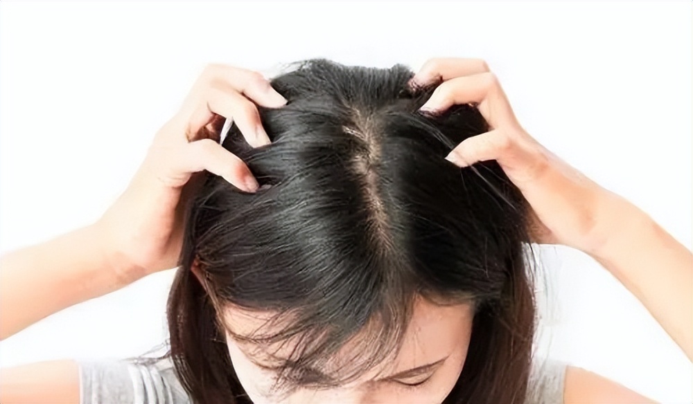 Kunming Scalp Management: What are the factors that cause hair loss?How ...
