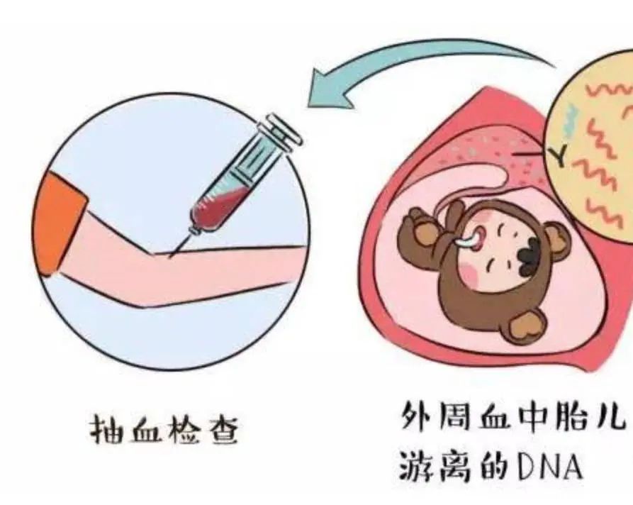 Non-invasive DNA-Plus upgrade!Detects 100 chromosomal disorders - iNEWS