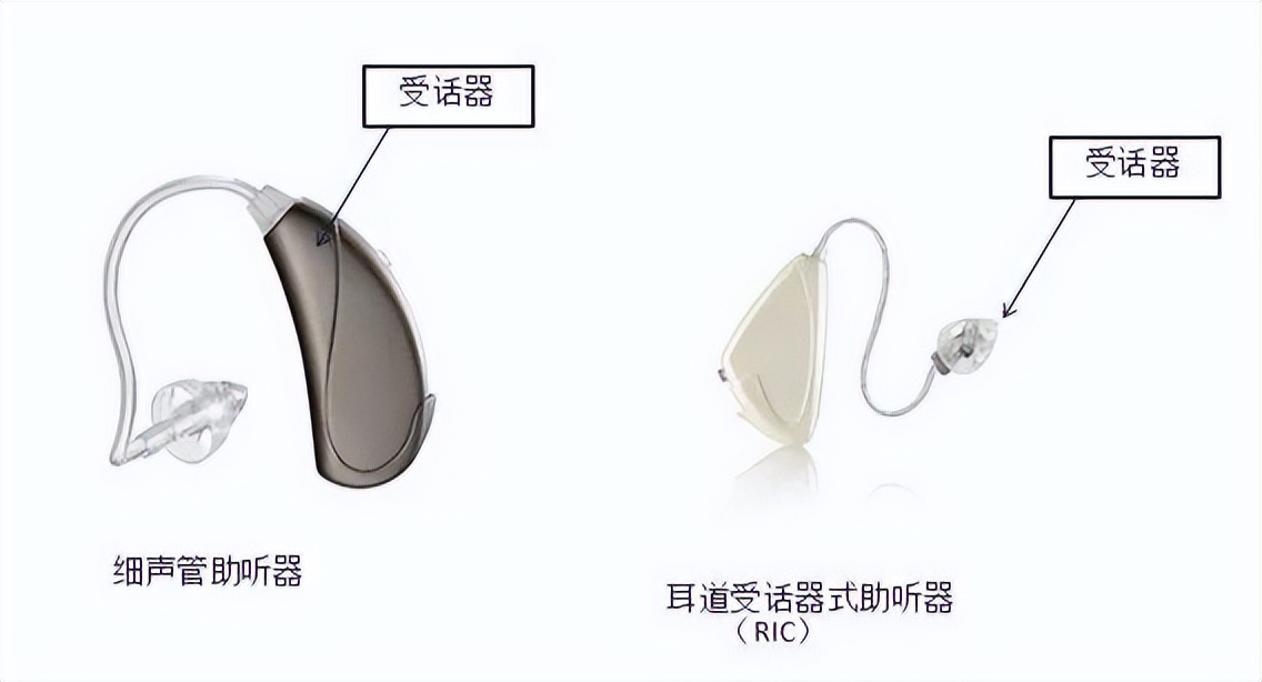 Miss Wan with hearing aids: Before choosing a hearing aid, you must ...