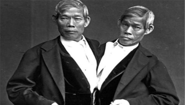 The Chinese Siamese brothers became famous for their performances ...