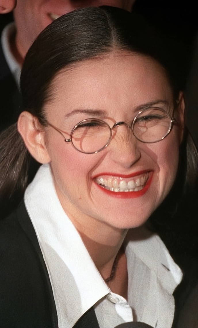 12 Celebrities Who 'Glowed With Teeth Remodeling' - iNEWS