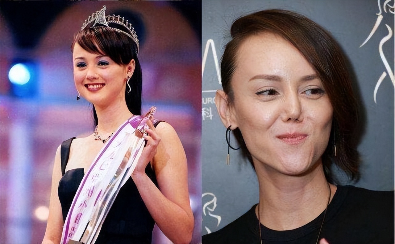 The faces of several celebrities with excessive plastic surgery have ...