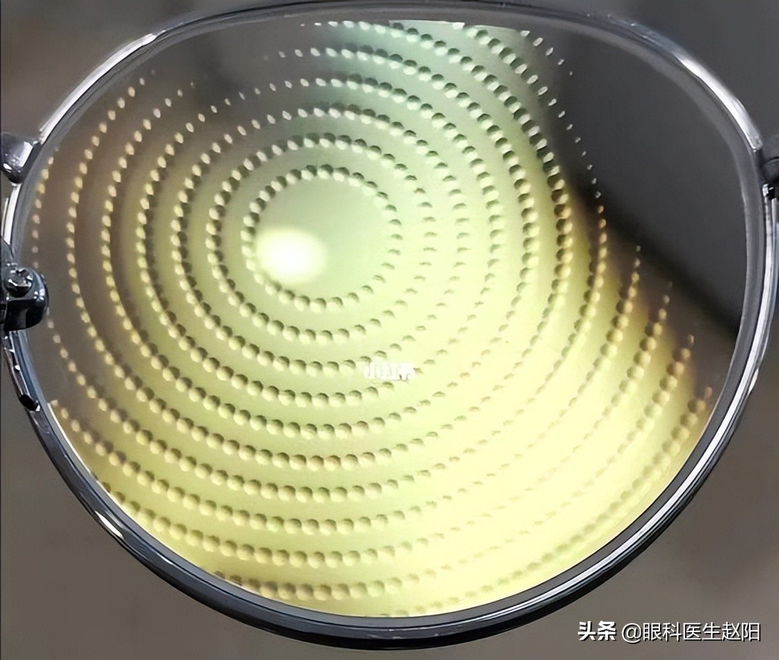 Lecture 4 (3) Peripheral Imaging Advance - Peripheral Defocus Lens - iNEWS