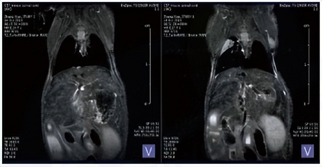 In vivo imaging methods for our small animals - iMedia