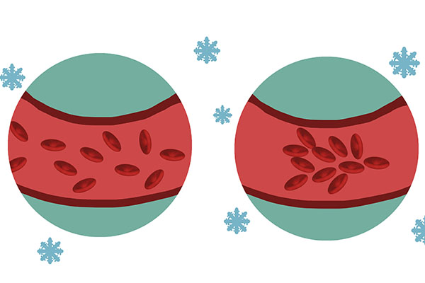 People with qi and blood blockage usually have 4 kinds of symptoms in ...