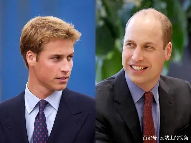 The two major genes of the British royal family, buck teeth, come from ...
