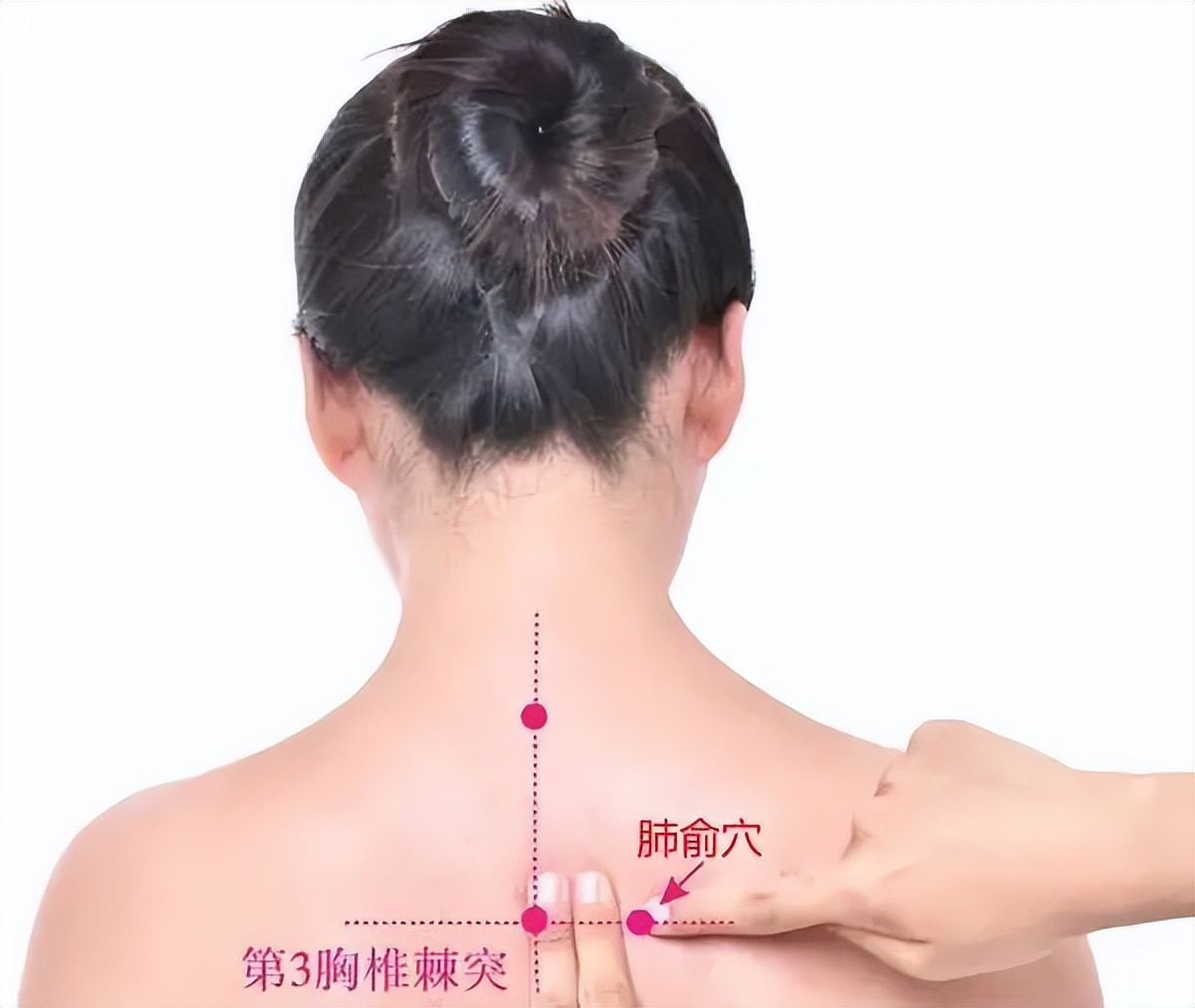 Ophthalmology Chinese medicine tells you: eye bags, moxibustion on ...