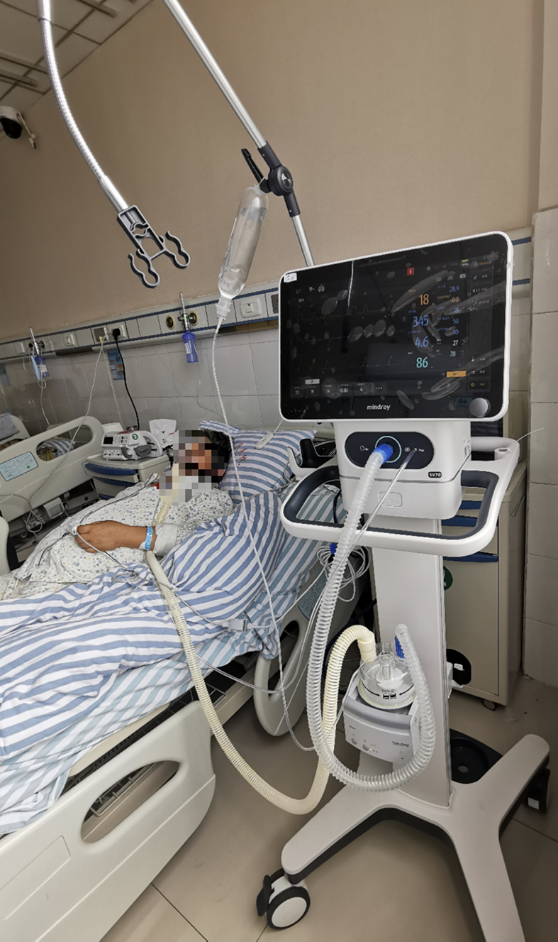 Mindray pushes differentiated innovation of the first non-invasive ...