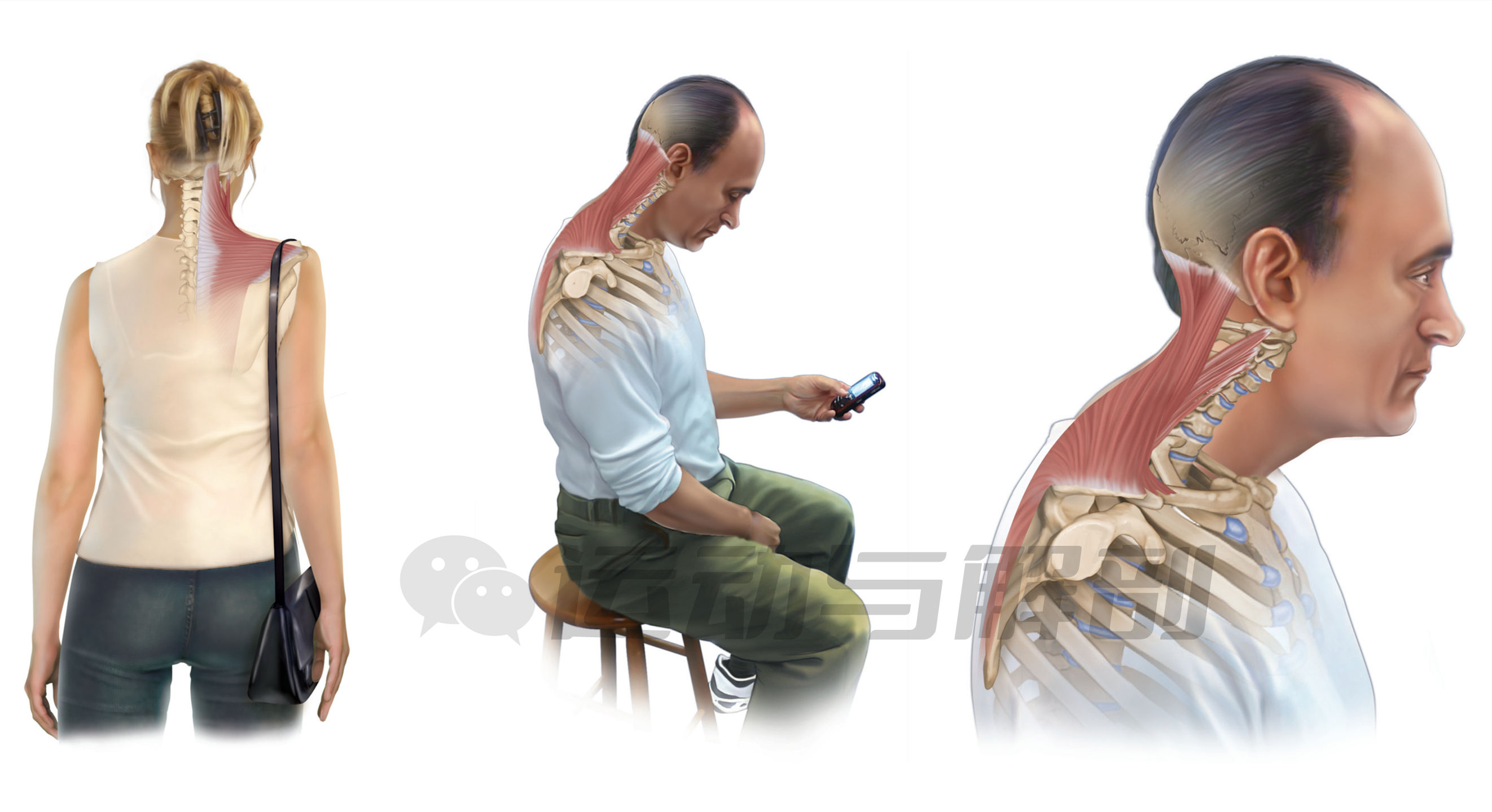 6 truths about trapezius muscle compensation, girls must read! - iMedia