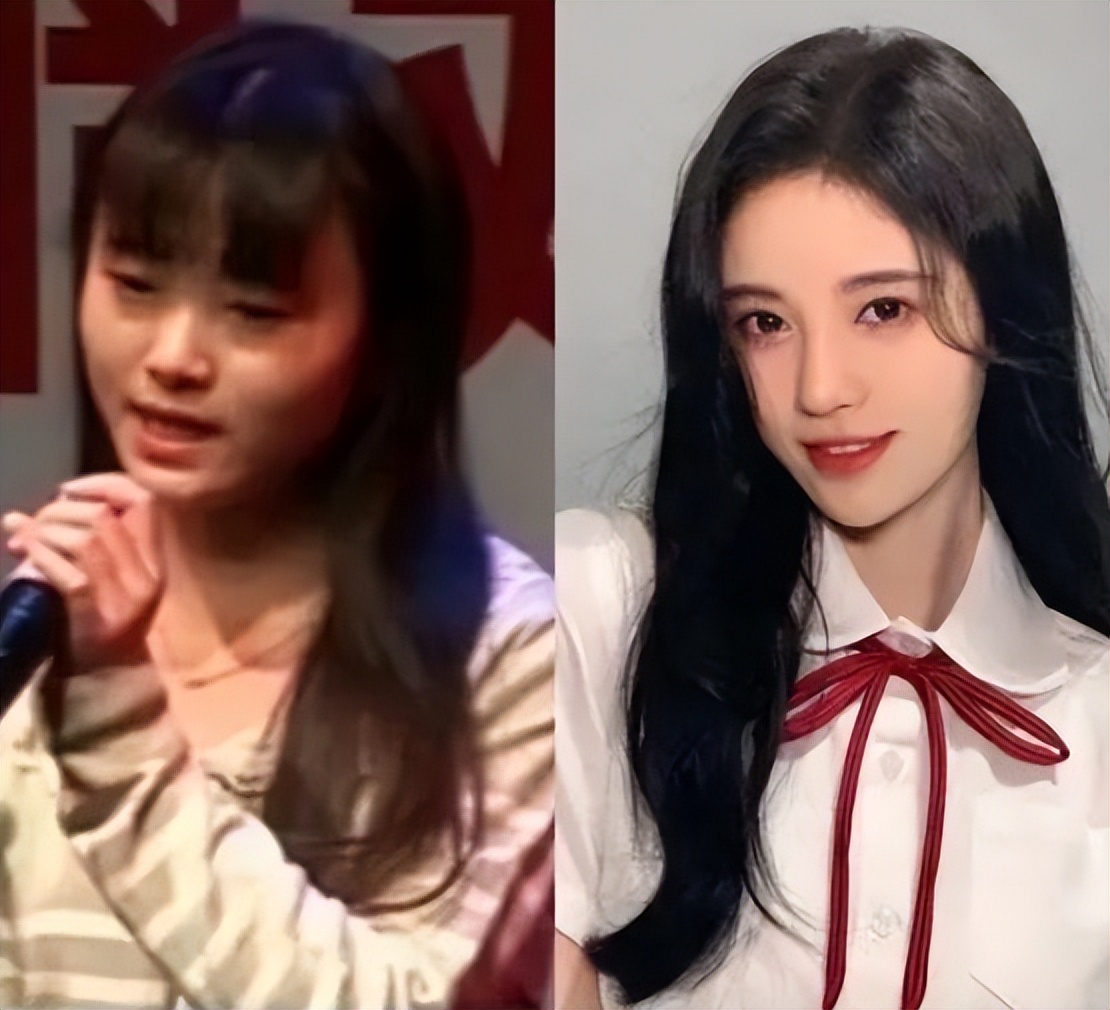 These female celebrities have obvious signs of plastic surgery, but ...