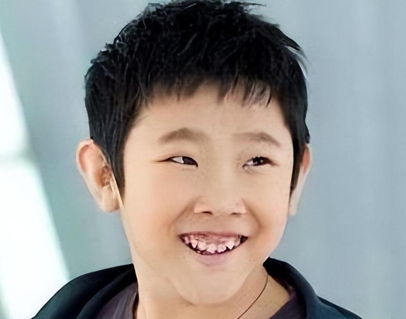 Hou Xiang: He stopped developing at the age of 9, and he can only act ...