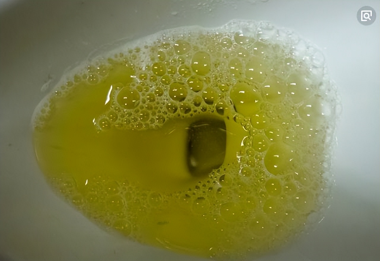 Hot and humid summer, yellow urine, diarrhea? A box of Chinese patent ...