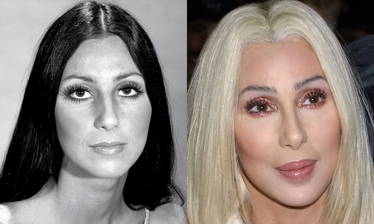 12 Hollywood stars with iconic body parts: Implants and injections work ...