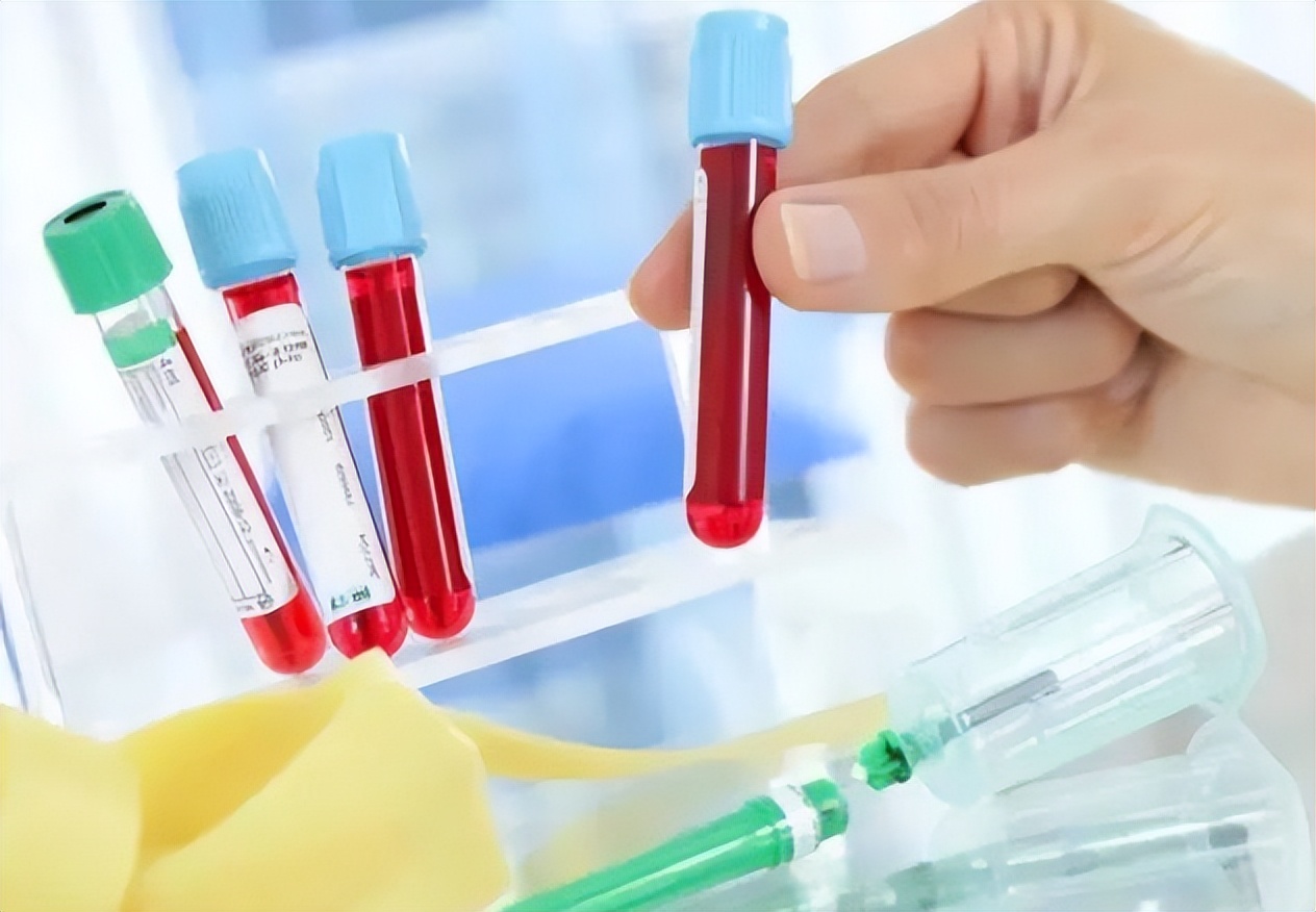 In the blood routine examination, if these 3 indicators are elevated ...