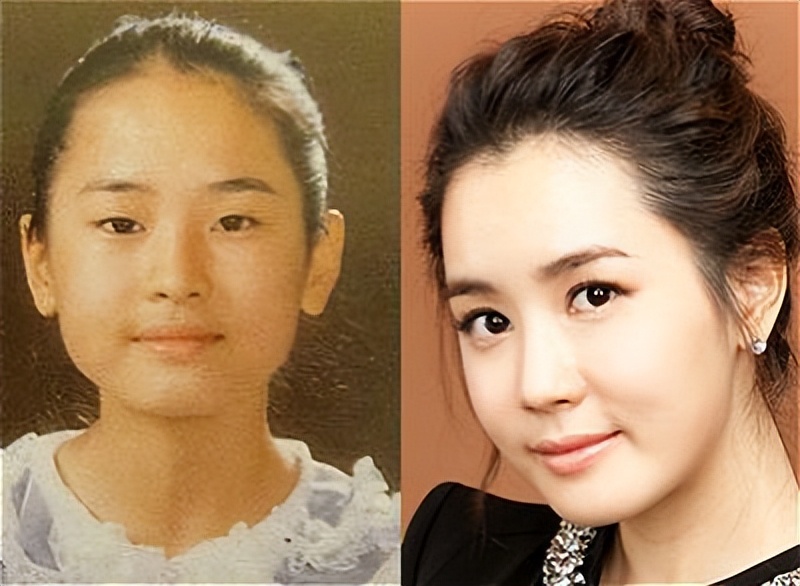 It took ten years to undergo plastic surgery to become a celebrity on ...