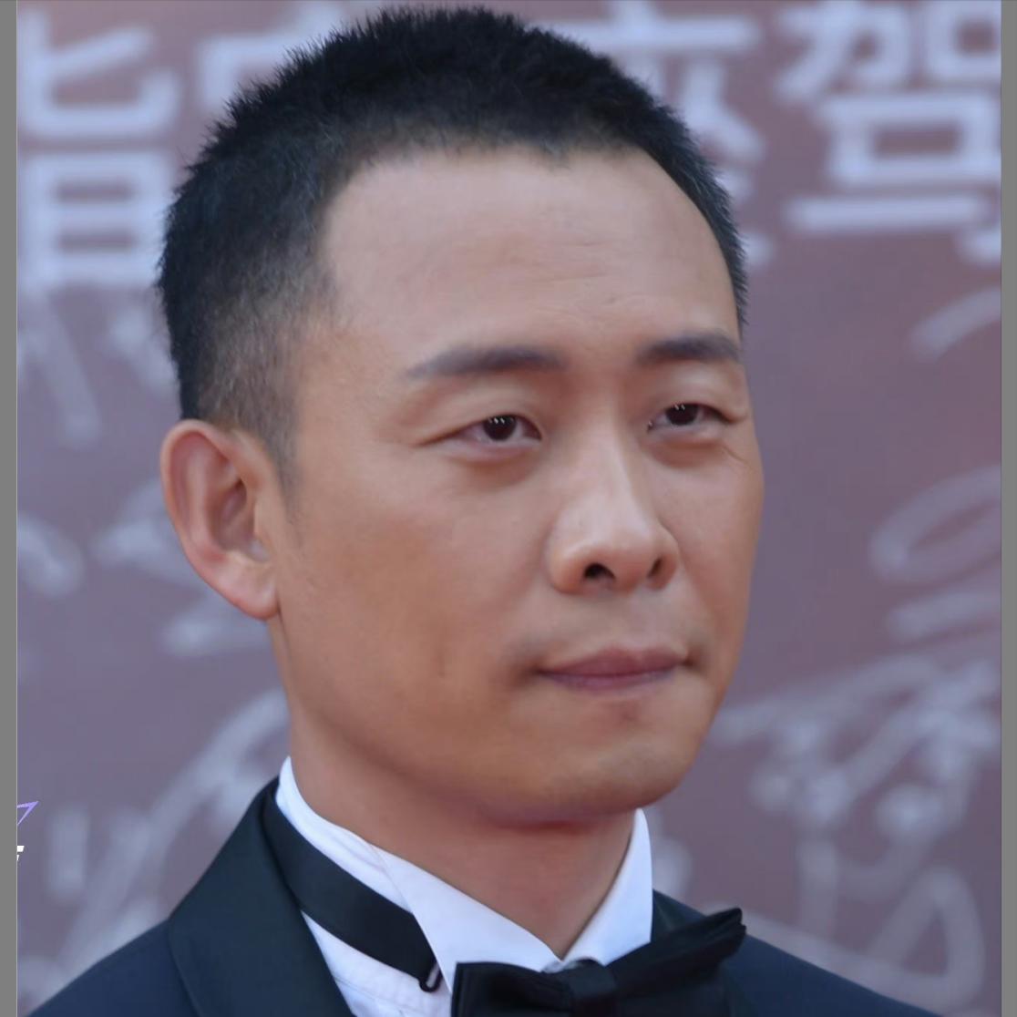 The male star under the face-to-face picture, with a swollen face and ...