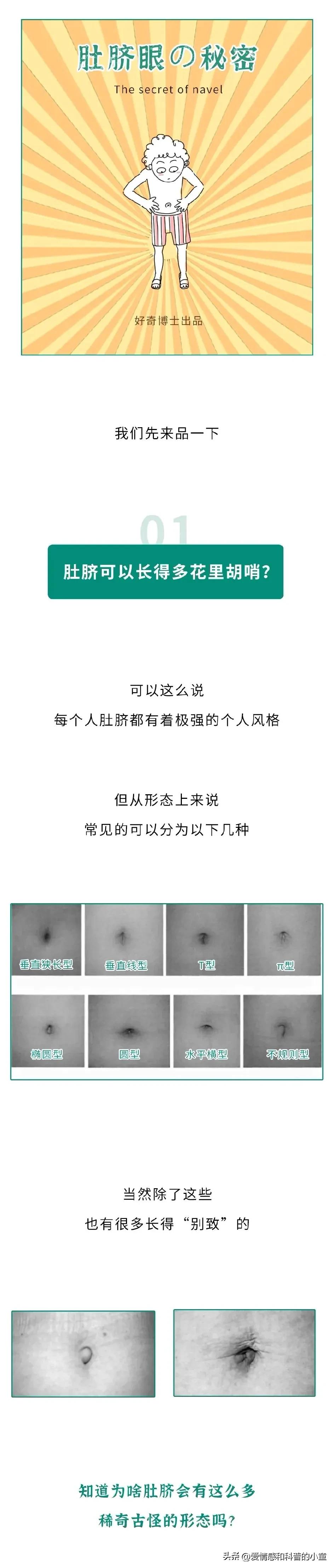 Belly buttons come in all kinds of strange shapes: come in and see what ...