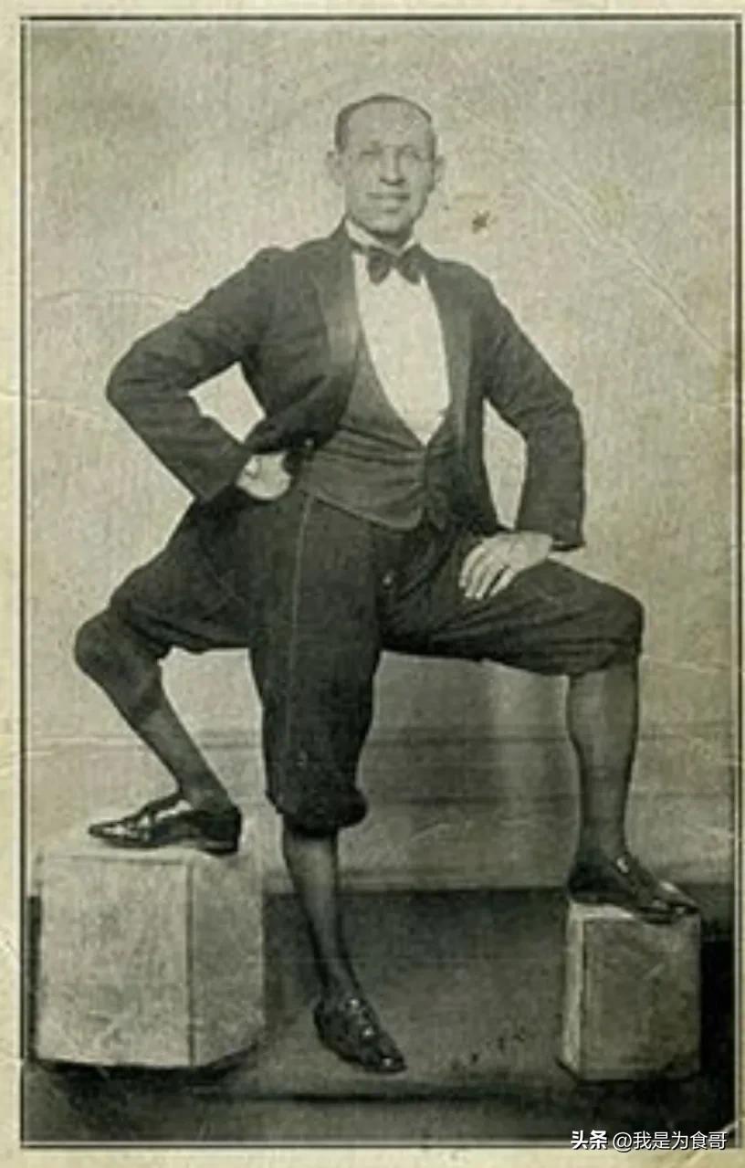 With 3 legs, 4 feet, 16 toes and 2 sets of normal genitalia, he lived a ...