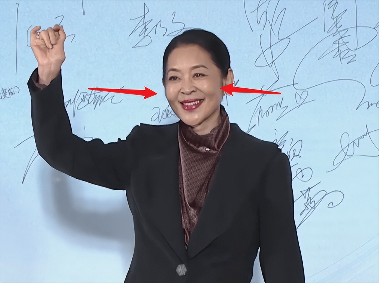 64-year-old Ni Ping has obvious signs of plastic surgery, the tip of ...