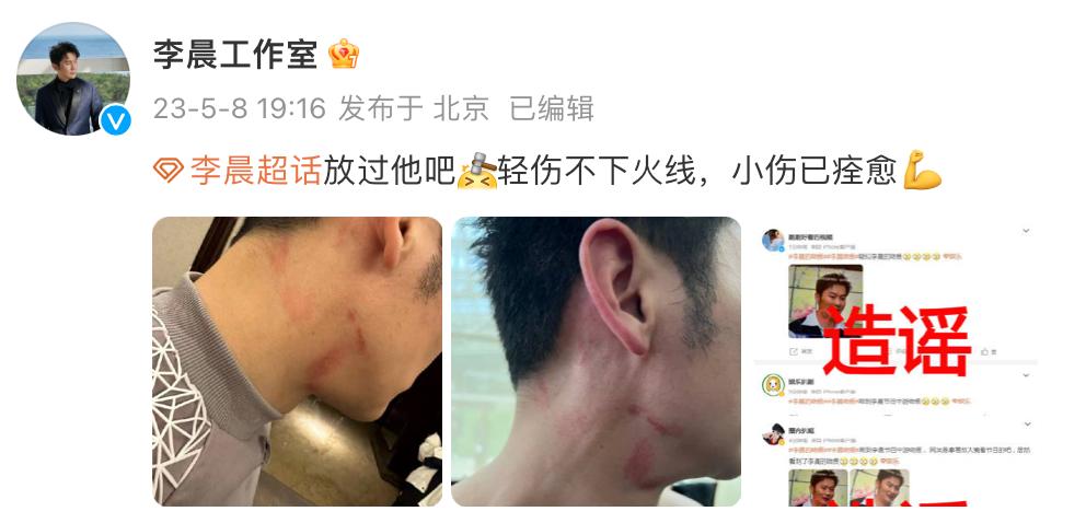 Li Chen was exposed to have hickey marks on his neck, suspected of ...