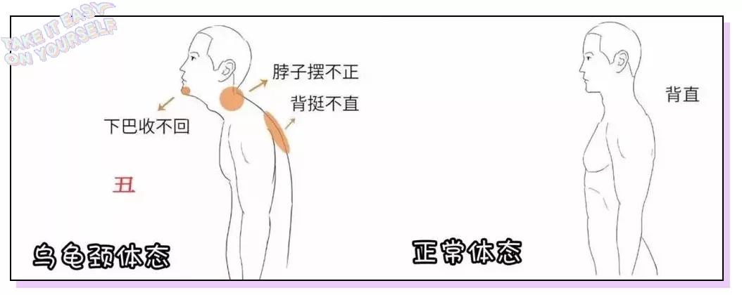 Star hunchback VS not hunchback, not appearance but posture - iNEWS