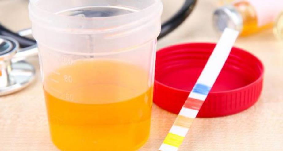 Popular Science: What's the matter with foam in urine? - iNEWS