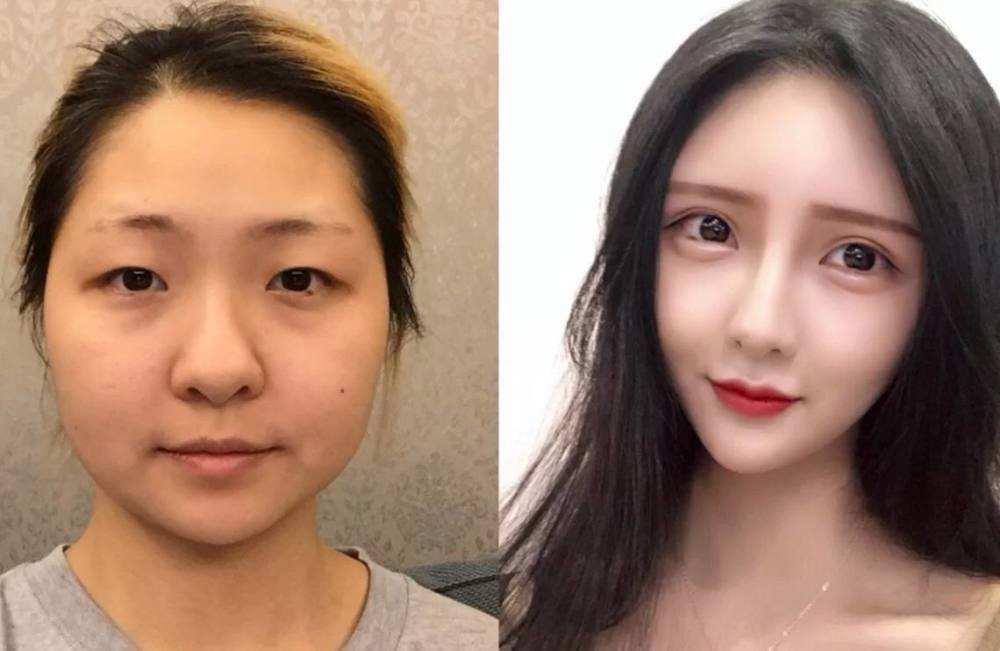Because of plastic surgery, her figure has changed a lot, and she has ...