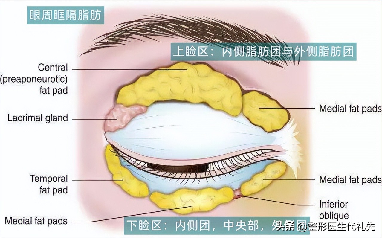 What causes sunken eye sockets?Can sunken eyes heal naturally?How to ...