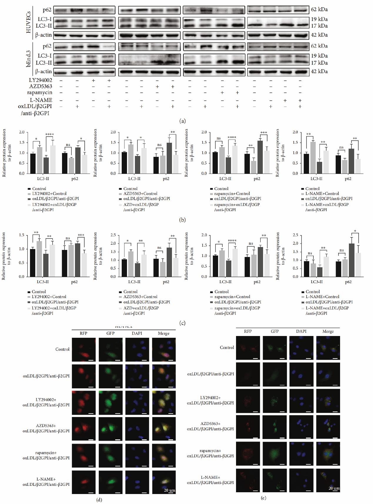 Impaired autophagy induced by oxLDL/anti-β2GPI complex through PI3K and ...