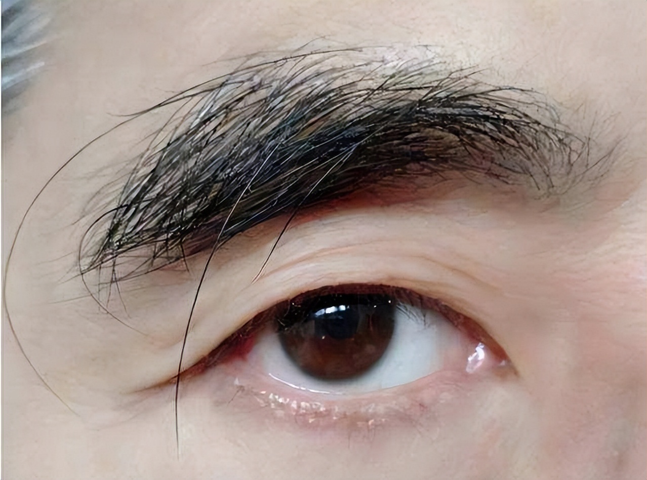 What does it mean when men's eyebrows grow longer after 50?The doctor ...