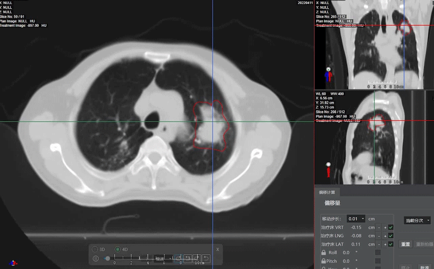 In pursuit of the king of all diseases, United Imaging's new clinical ...