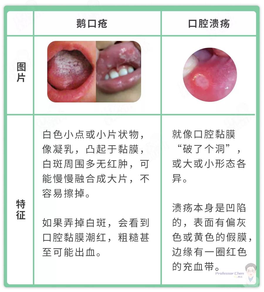 How to deal with thrush in baby - iNEWS