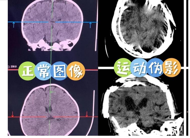 How are "CT" films made?One minute science tells you, please collect ...
