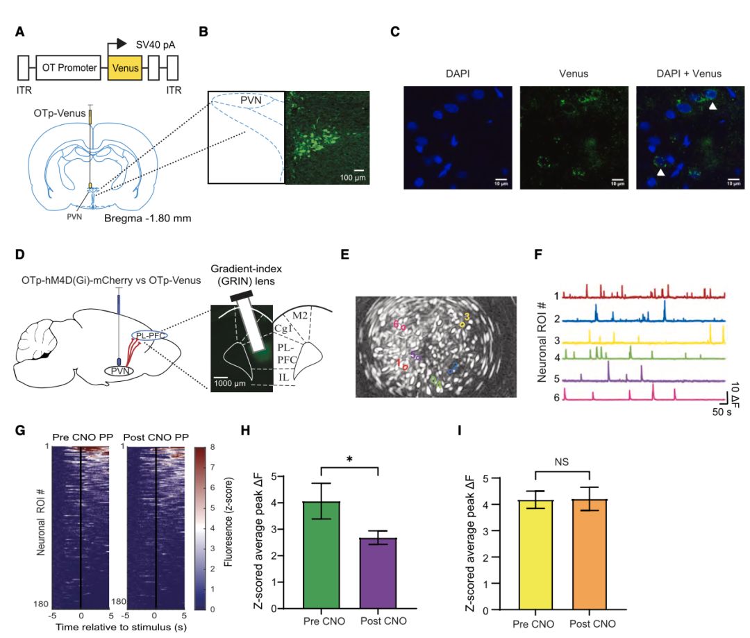 Neuron: a new circuit mechanism for the analgesic action of oxytocin ...