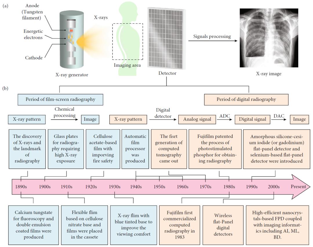 The future and challenges of X-ray imaging technology development - iNEWS