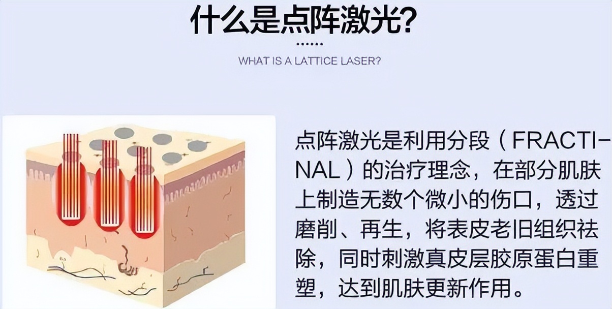 A special session on acne scars and acne pits, explaining all the ...