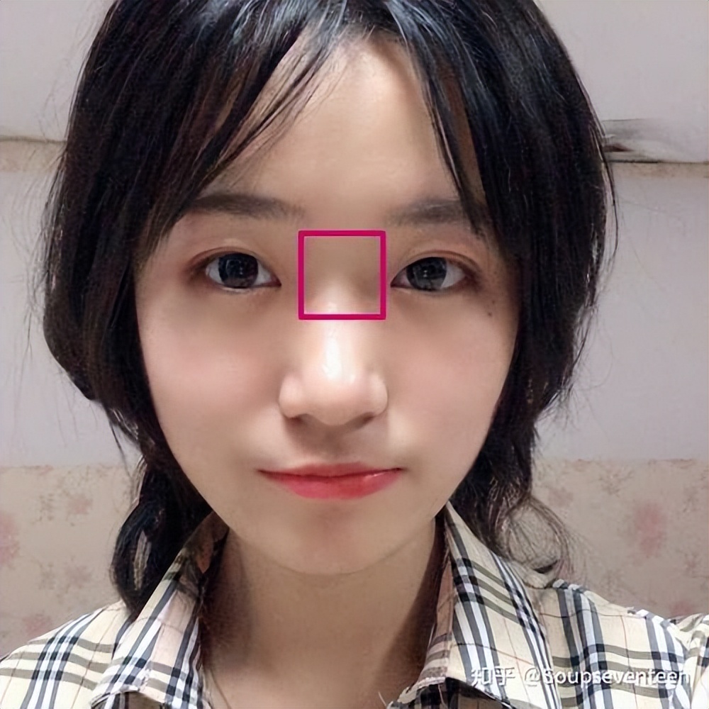 Which "flat noses" don't need to be moved?Which "flat noses" need to be ...