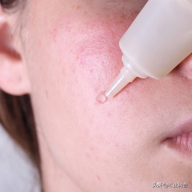 What's the matter with bad skin and enlarged pores? These methods are ...