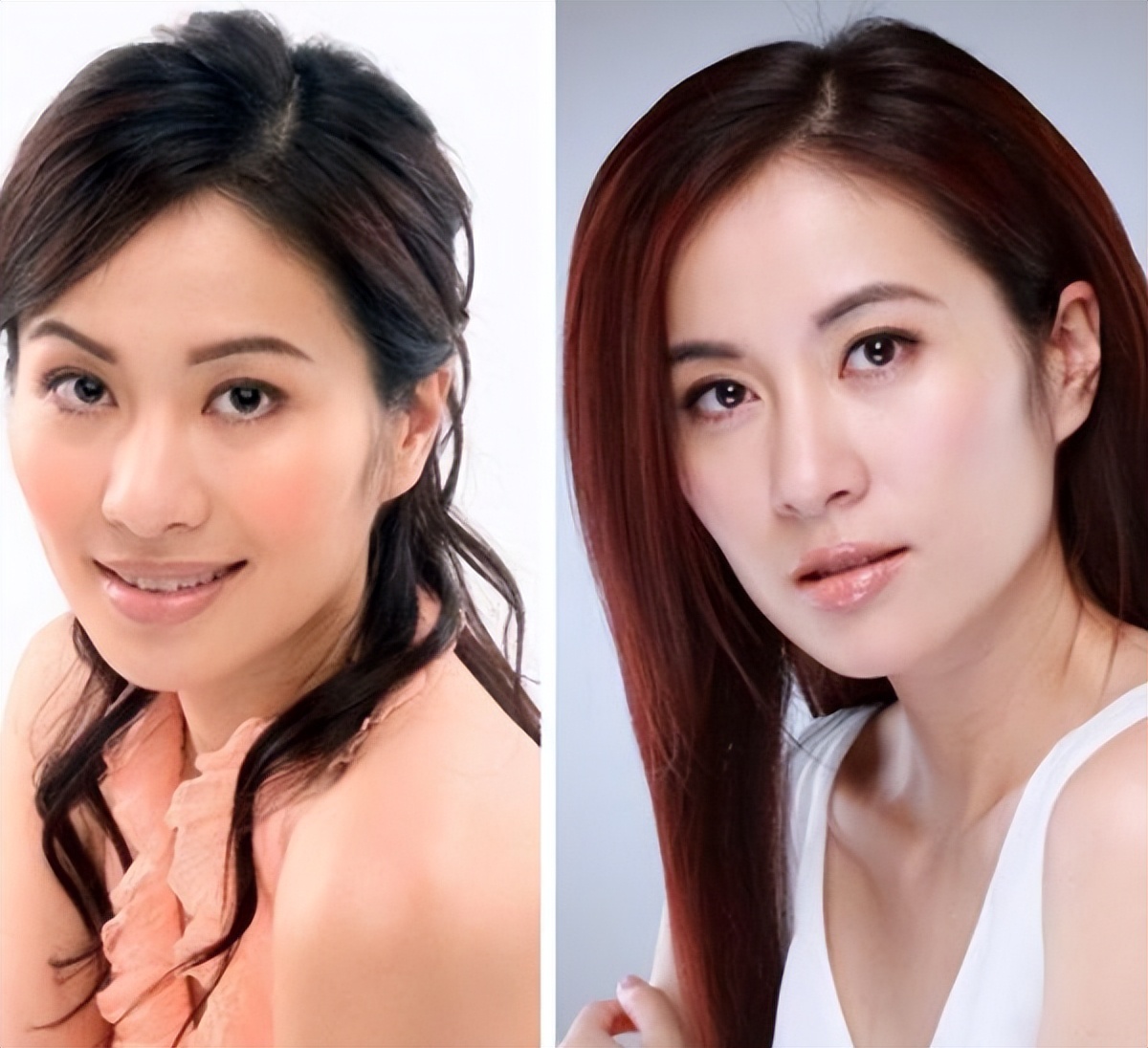 Plastic surgery is becoming more and more fashionable?These TVB ...