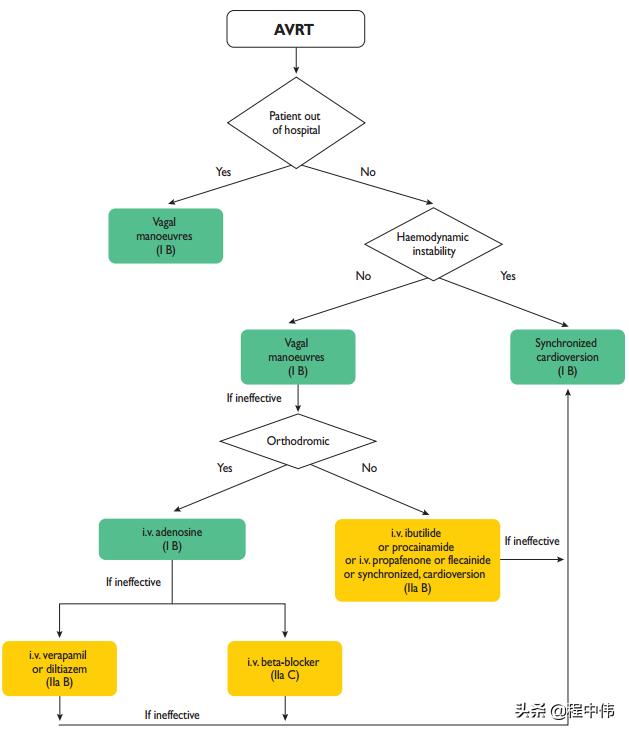 2019 ESC Supraventricular Rate Processing Guidelines (6): AVNRT and ...