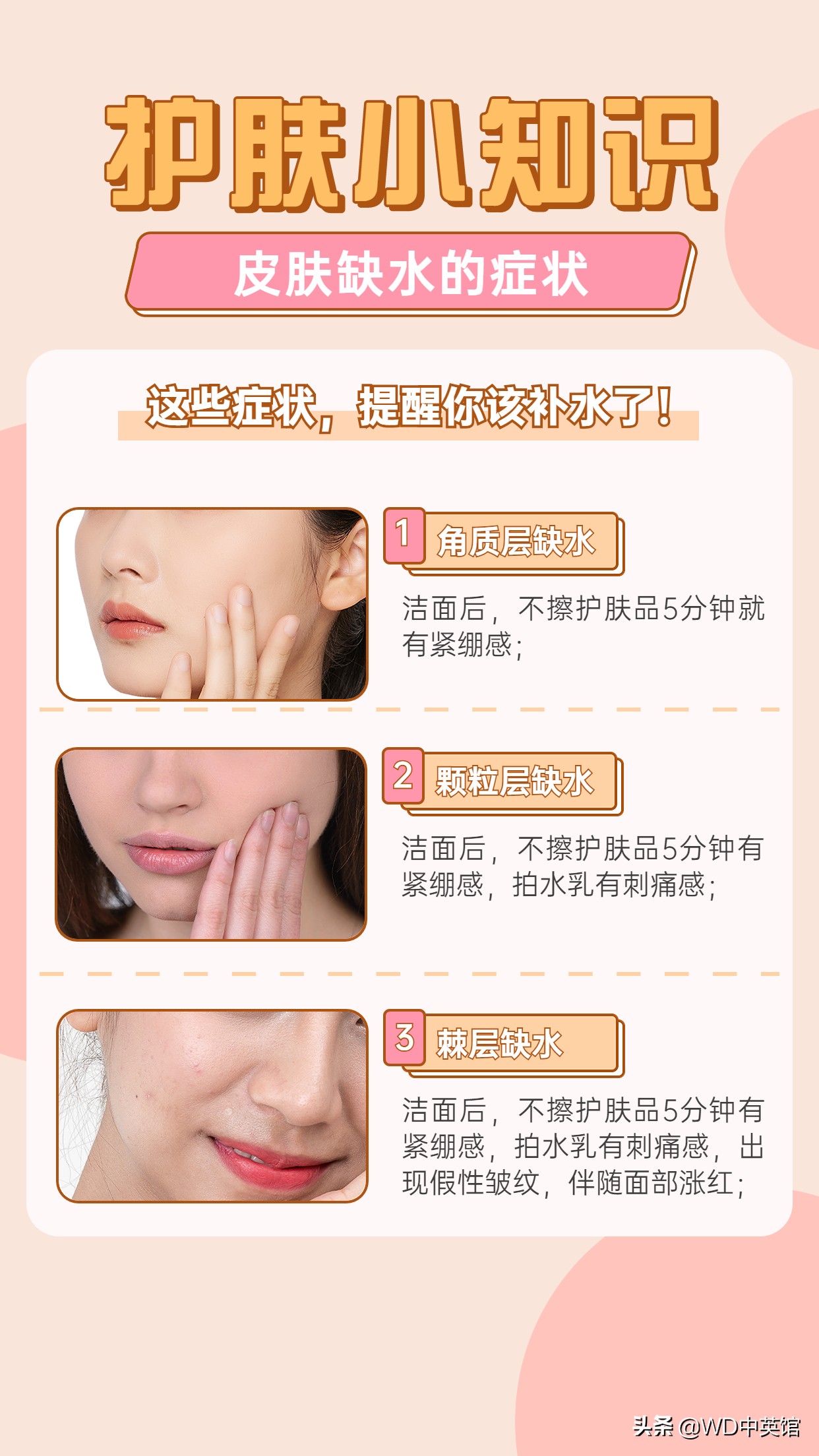 Symptoms of dehydrated skin; these symptoms remind you to hydrate - iNEWS